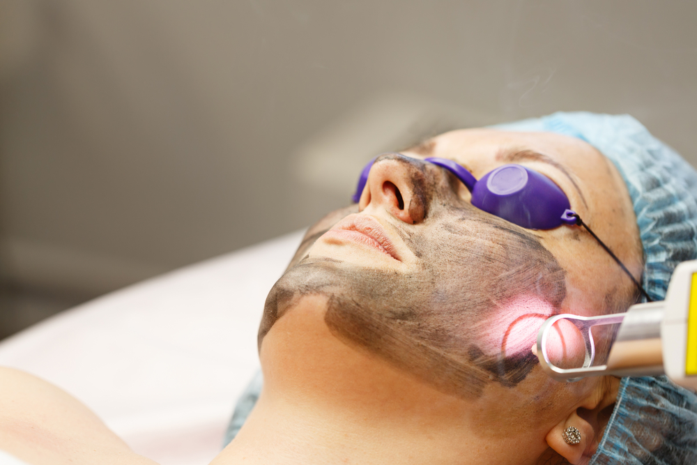 Dive Into the World of Carbon Laser Therapy and Its Astonishing Skin ...