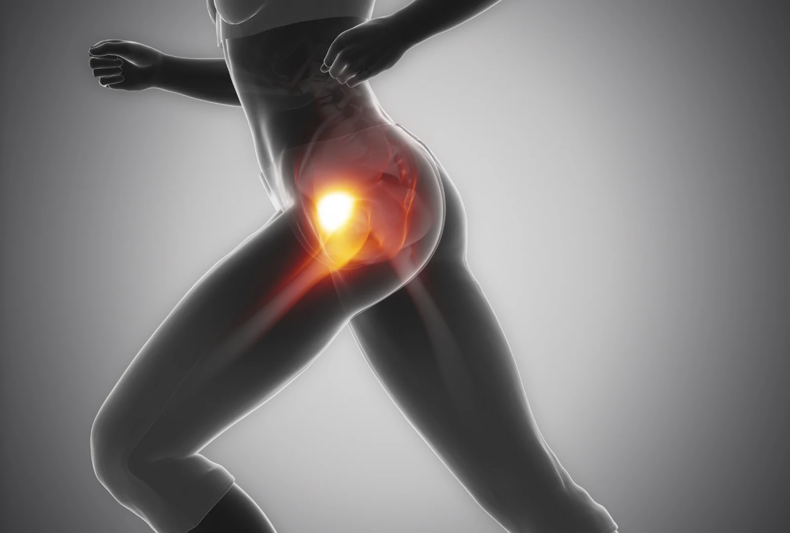 Effective Ways to Prevent and Relieve a Pinched Nerve in the Hip ...